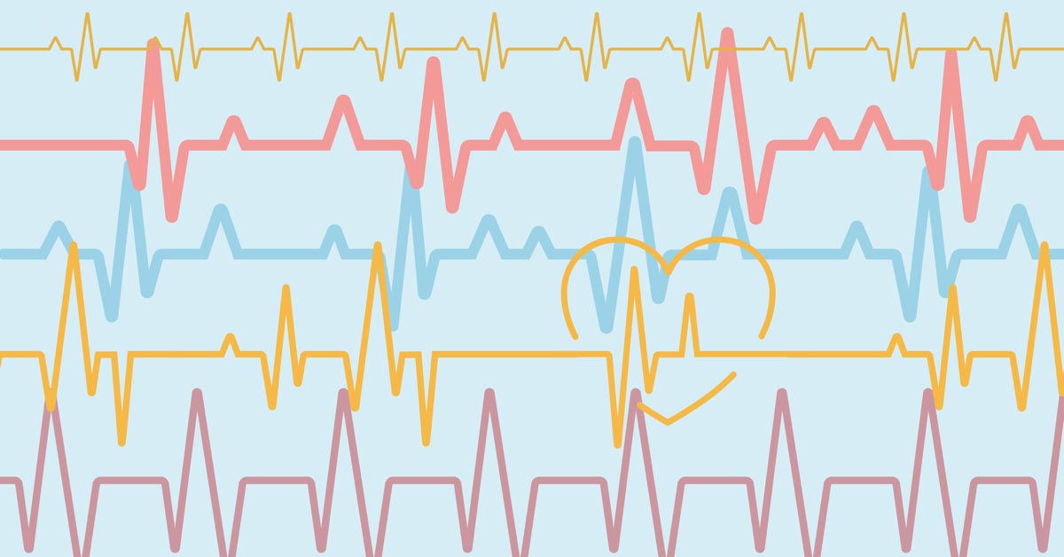 A Kid's Perspective on Getting an EKG | Heart-Failure.net