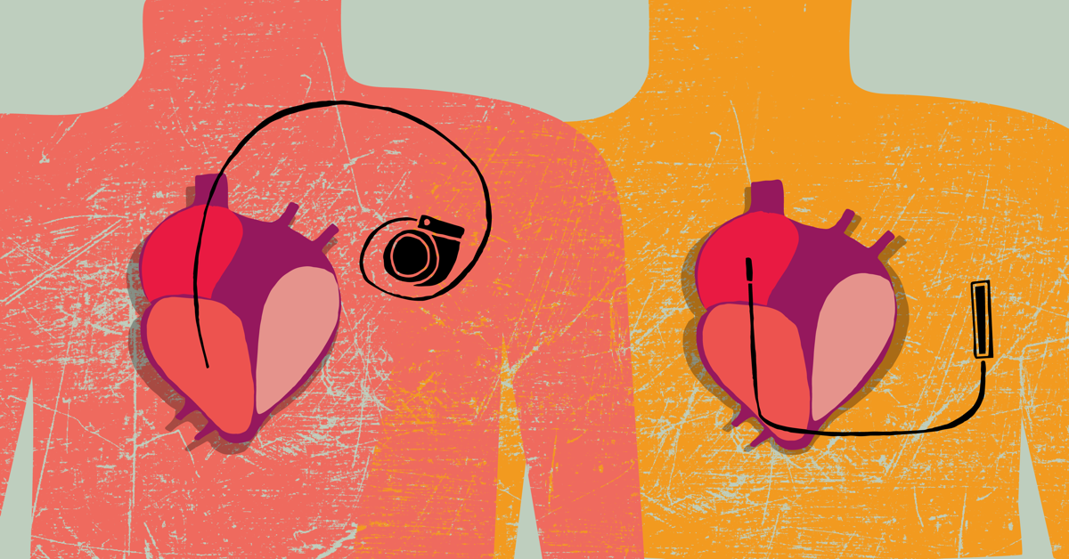 Living with an Implantable Device for Heart Failure